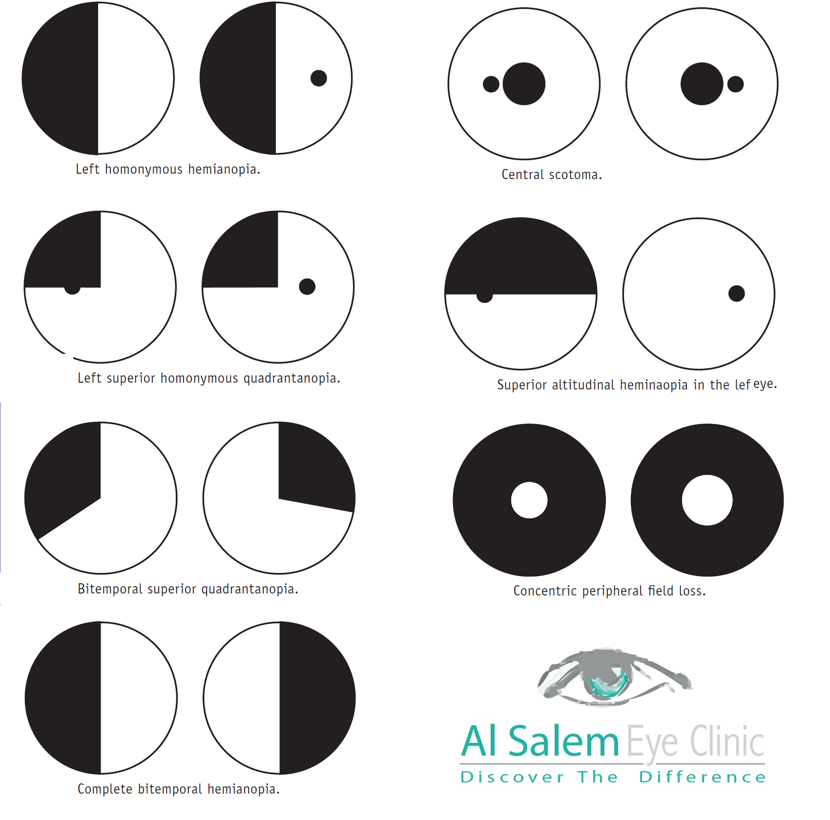 Neuro-ophthalmology 2 – AL-Salem Eye Clinic